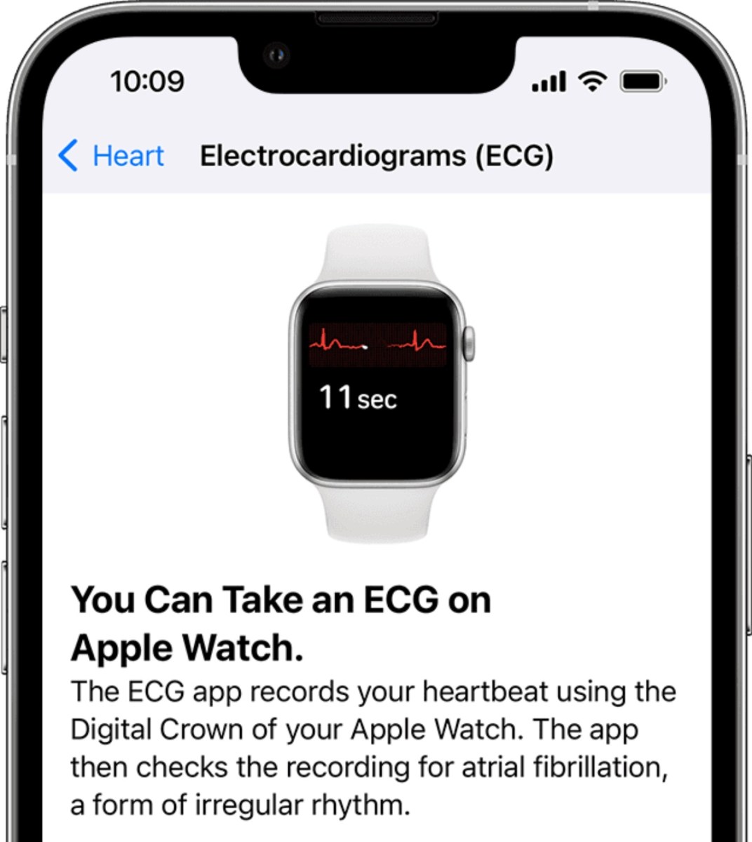 Apple Watch has a slight advantage over competing devices in providing ...